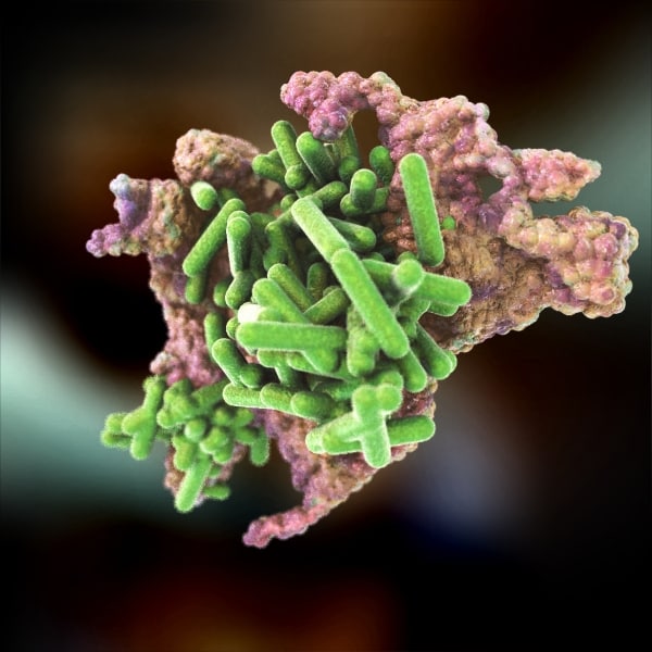 rickettsia bacteria cells max